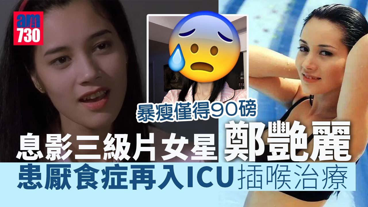 息影三級片女星鄭艷麗 患厭食症激瘦自爆再入ICU | am730